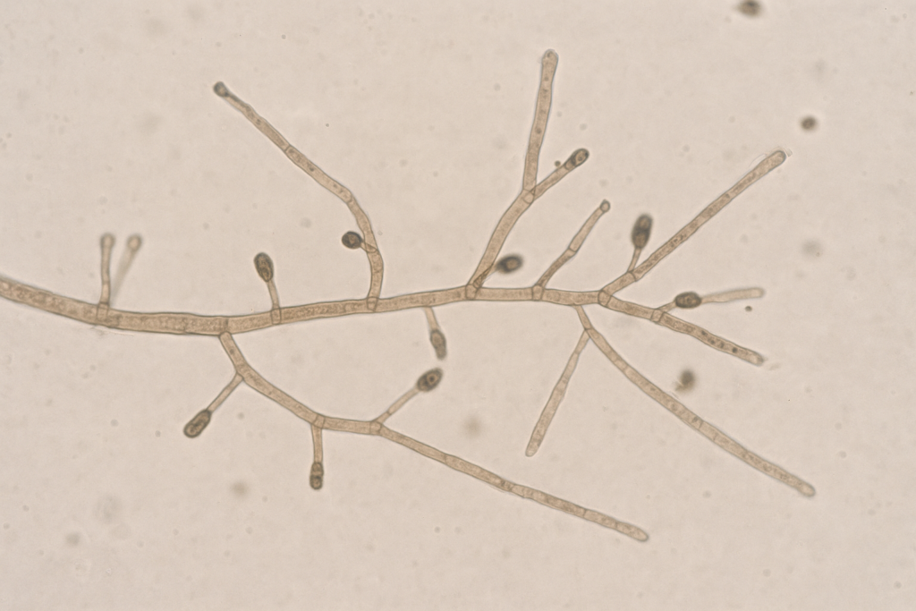 Mengenal Gliocladium virens, Partner Penting Trichoderma - Tridhataagro