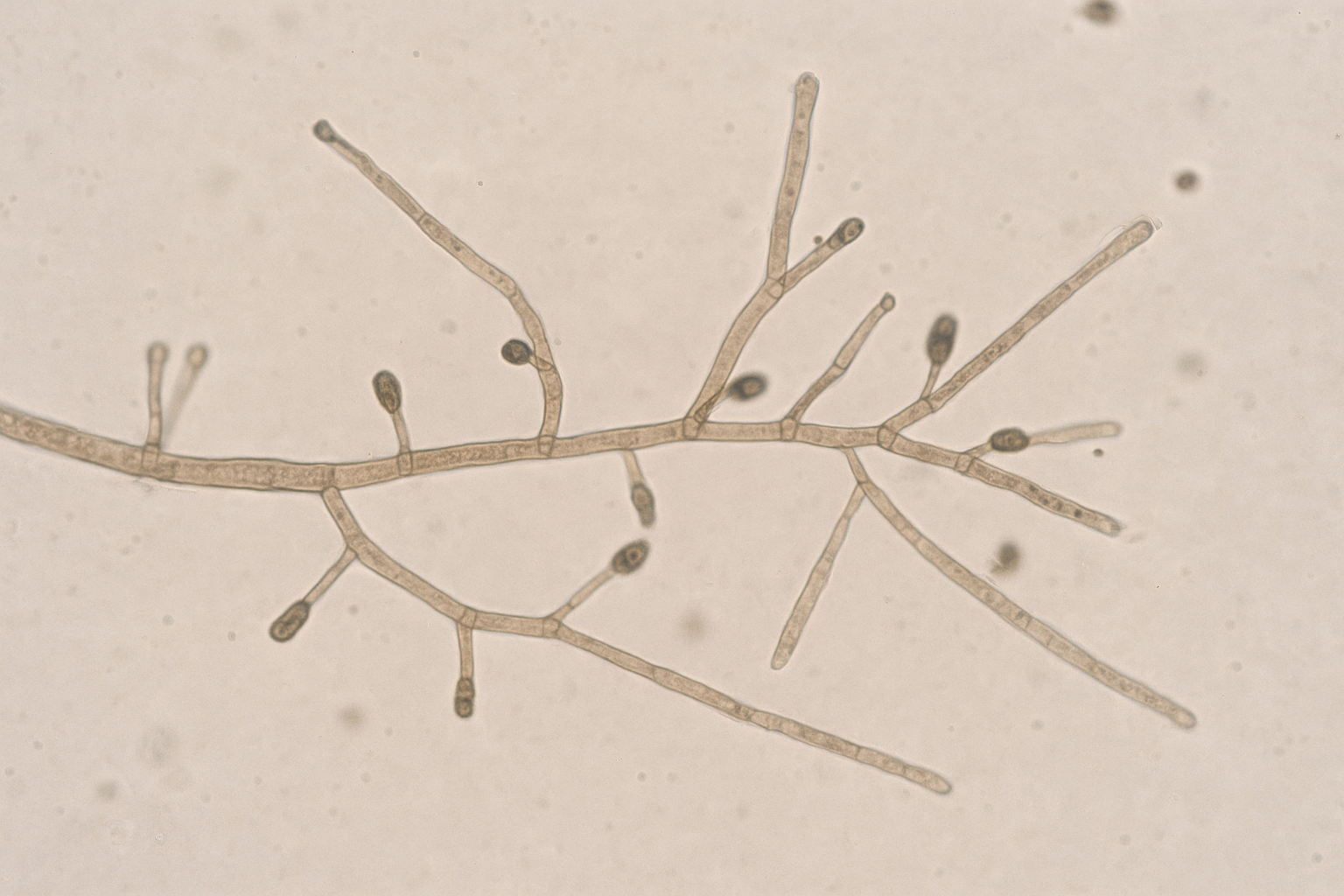 Mengenal Gliocladium virens, Partner Penting Trichoderma - Tridhataagro
